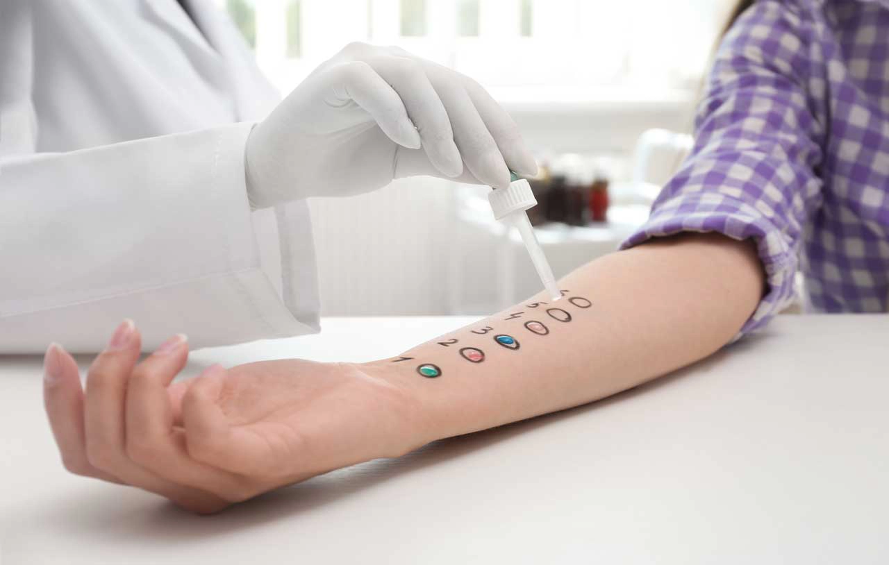 Prick Test (test cutané d’allergie) - One Clinic